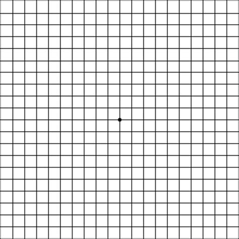 Eye Test For Macular Degeneration Nuffield Health