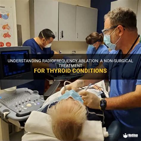 Understanding Radiofrequency Ablation A Non Surgical Treatment For