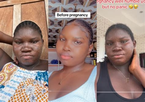 Nigerian Lady Causes Buzz Online As She Shows Off Before And After