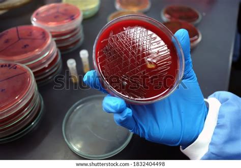 Streptococcus Suis ภาพสต็อกปลอดค่าลิขสิทธิ์และรับสิทธิ์ใช้งานได้กว่า 9 รายการ Shutterstock