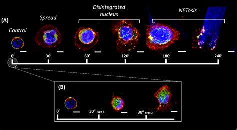 Figure 1 From Stages Of Netosis Development Upon Stimulation Of Neutrophils With Activators Of