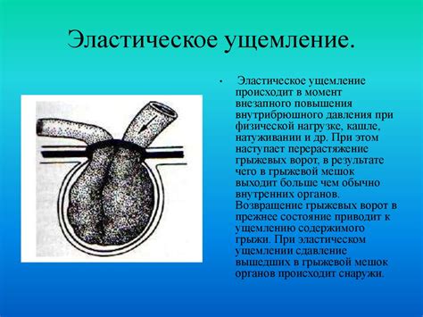 Ущемленная паховая грыжа презентация онлайн