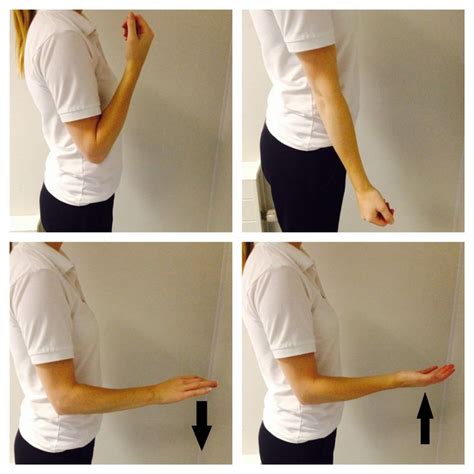 Proximal Humerus Fracture Virtual Fracture Clinic