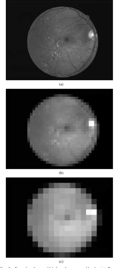 Figure 3 From Fast And Robust Optic Disc Detection Using Pyramidal Decomposition And Hausdorff