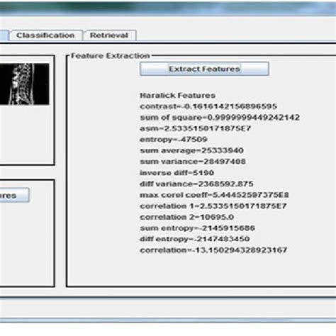Output Screen For Haralicks Texture Feature Extraction Download Scientific Diagram
