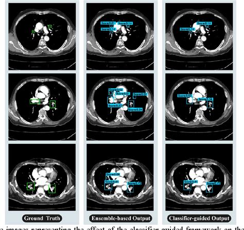 Figure 1 From Deep Learning In Computed Tomography Pulmonary