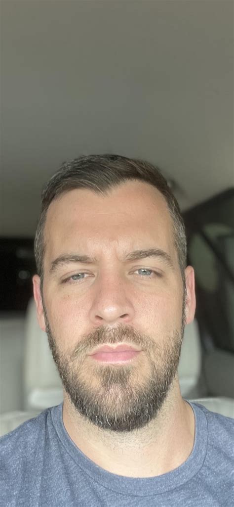 6 Month Update On Taltz R Psoriasis