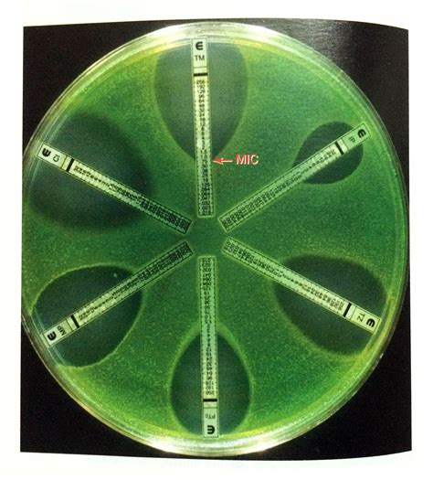 Etest Ritus Biology Hub