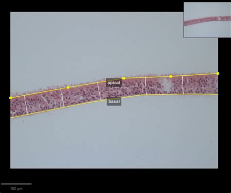 Error On Qupath Scrip For Thickness Epithelium Measurement Image