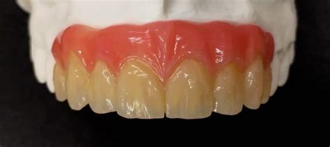 Advanced Indirect Twiny Composite Course Hughes Dental Laboratory