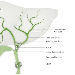Anatomical Classification Of Cholangiocarcinoma Download Scientific Diagram
