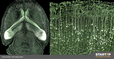 Precision Light Sheets For 3d Microscopy Inits