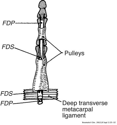Fdp Fds Anatomy Bilateral Accessory Flexor Muscle Of