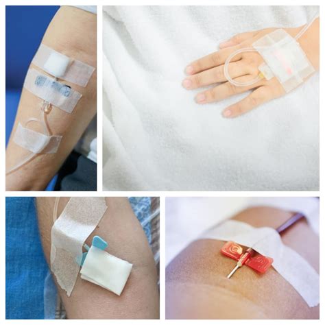 Butterfly Needle Scalp Vein Set Buy Product On Horizon Medical