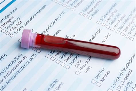 GGT Blood Test What a High or Low Result Means Tua Saúde