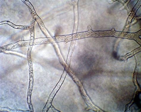 Penicillium Septate Hyphae