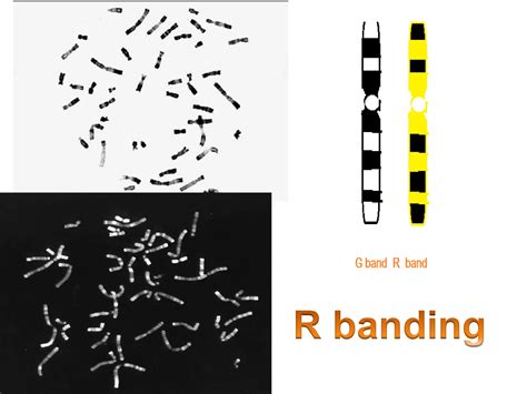 Chromosomal Banding Technique Ppt