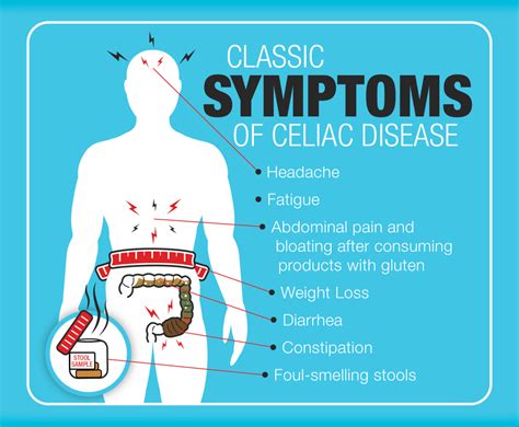 Understanding Celiac Disease And Turner Syndrome Turner Syndrome