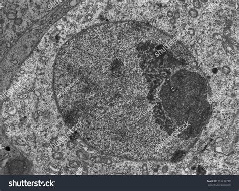 Transmission Electron Microscope Tem Micrograph Showing Stock Photo