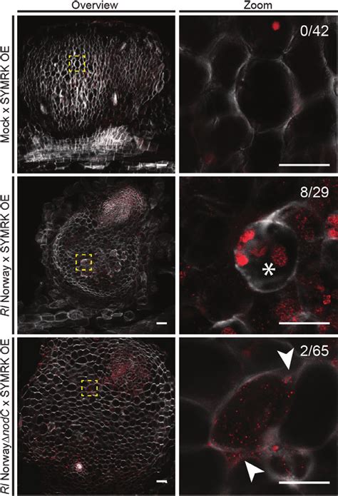 Infection Of Spontaneously Induced Nodules In The Absence Of Nod Download Scientific Diagram