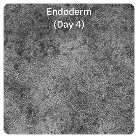 Ipsc Organoid Models Axion Biosystems