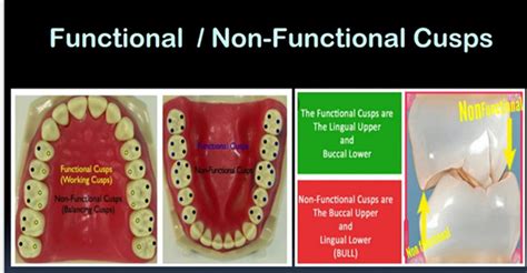 Best Dental Hospital In Hyderabad Dental Clinic In Malkajgiri