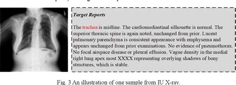 Figure 4 From Dynamic Multi Domain Knowledge Networks For Chest X Ray Report Generation