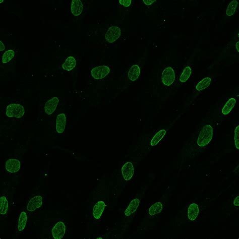 Imagej Measuring Fluorescence Intensity Fluorescence Analysis With