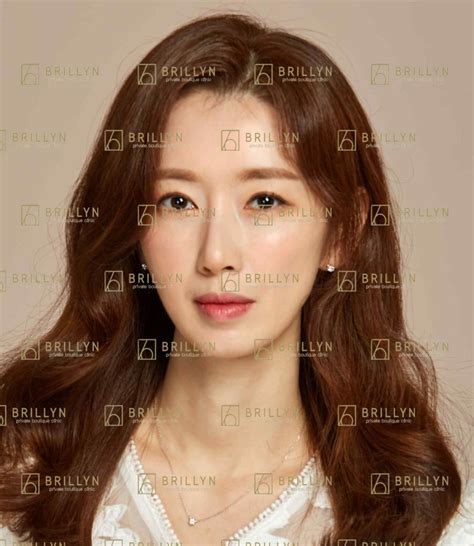 피코슈어토닝 효과 경과별로 개선된다면 네이버 블로그