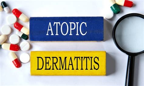 Categoría Dermatitis Words De Imágenes Fotos De Stock E