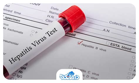 آزمایش هپاتیت چیست؟ بهترین زمان برای آزمایش