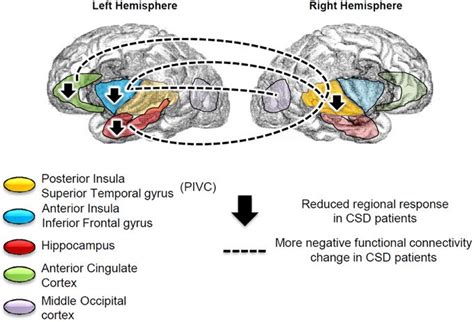Anterior Cingulate Cortex Cingulate Cortex Occipital