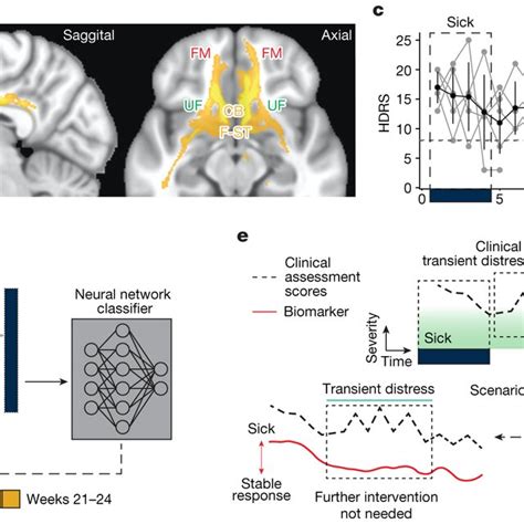 Overview Of Study Procedures A Coronal View Of The Dbs Lead Targeting