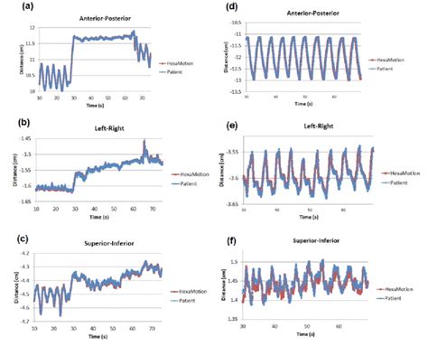 Comparison Of The Original Patient Baseline Waveform With The
