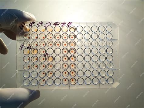 Premium Photo Tpha Enzyme Linked Immunosorbent Assay Elisa Plate