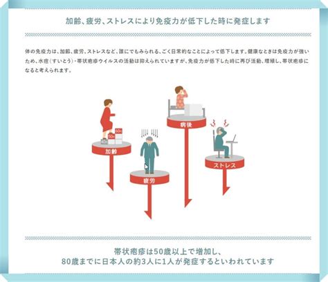 帯状疱疹 上野シニア倶楽部