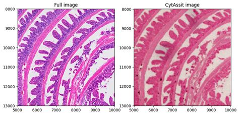Technology Focus Visium Hd — Spatialdata