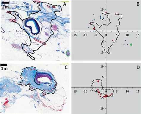 Figure 2 From Innervation Patterns May Limit Response To Endovascular