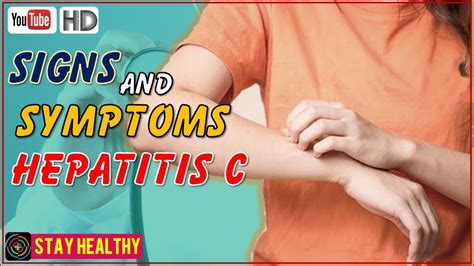 10 Signs And Symptoms Of Hepatitis C Youtube