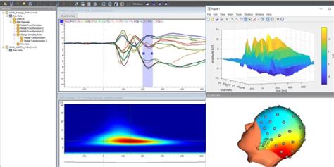 New Brainvision Analyzer 2 2 2 And Update Of Solutions