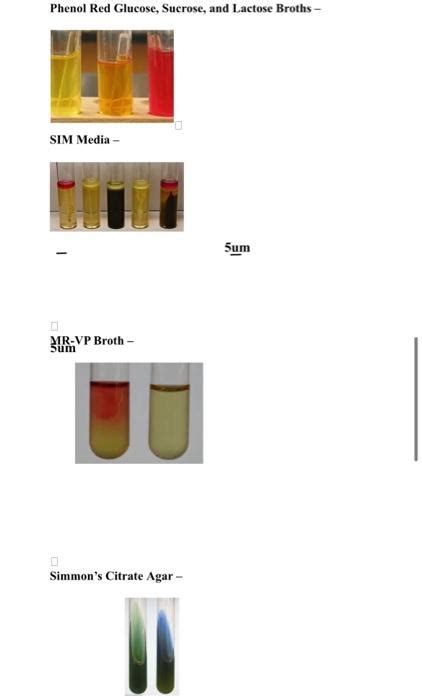 Solved Laboratory Exercise Bacterial Isolation And Chegg