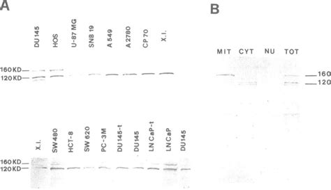 A Western Blot Of Total Protein Extracts Of Various Human Cell Lines