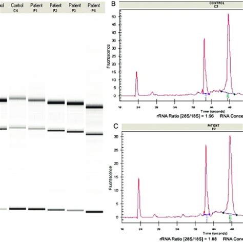 Quantitation Of The Purity Of The Rna Samples Agilent 2100 Bioanalyzer