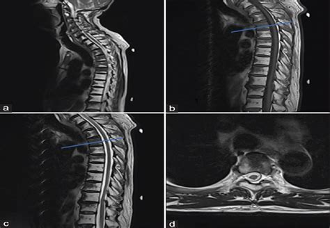 Indian Spine Journal