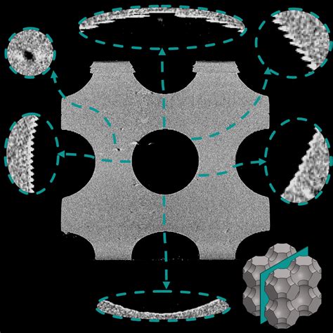 Ct Scan Front Slices Download Scientific Diagram