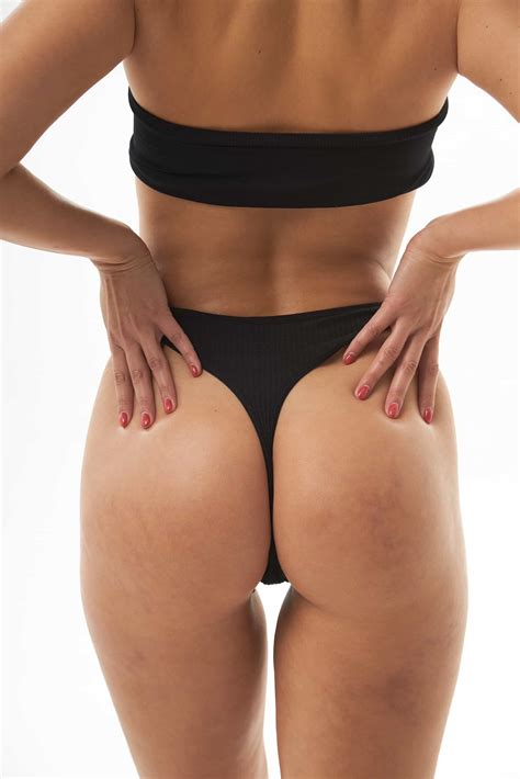 Butt Implants Aesthetics Hq