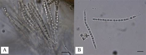 Asci And Ascospores Of Podostroma Cornu Damae Bo24623 A Cylindrical Download Scientific