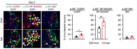 多色文献解读：神经病理性疼痛调控新机制 上海优宁维生物科技股份有限公司
