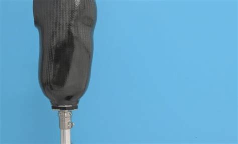 Custom Prosthetic Socket Fabrication With Cadcam