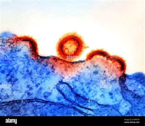 Transmission Electron Micrograph Of Hiv 1 Virus Particles Colorized Red Yellow Replicating From
